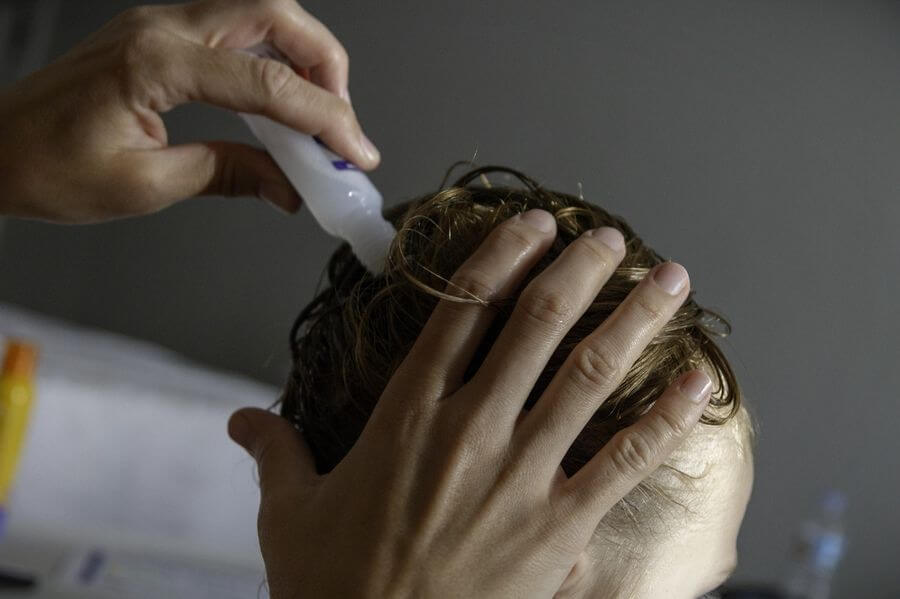 Que provoca el picor del cuero cabelludo - Instituto Quirúrgico Capilar ...