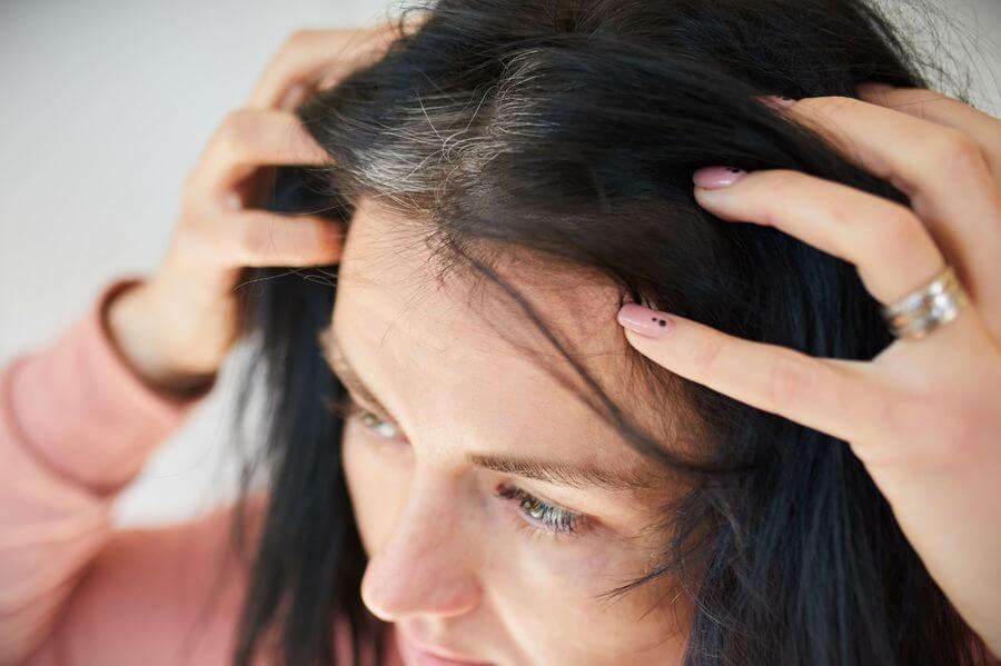 Que provoca el picor del cuero cabelludo - Instituto Quirúrgico Capilar ...